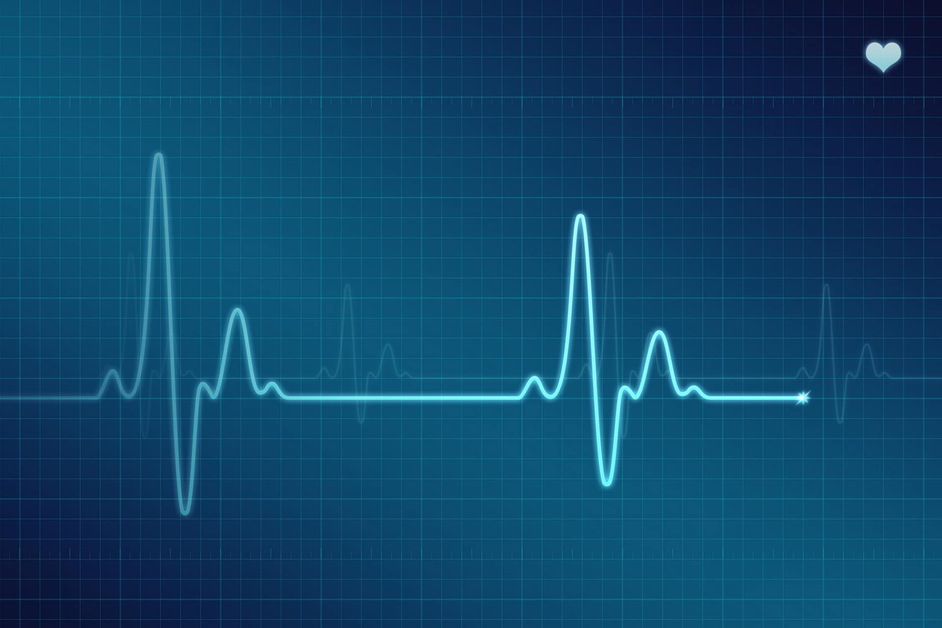 HR Vital Signs - The Hackett Group